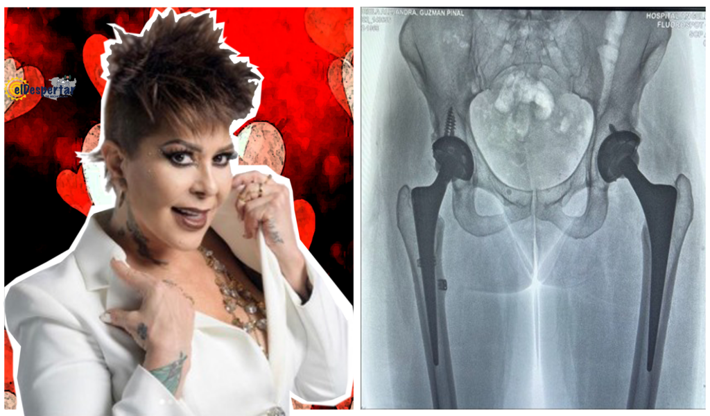 ALEJANDRA GUZMAN La cantante fue hospitalizada hace seis días luego de ...